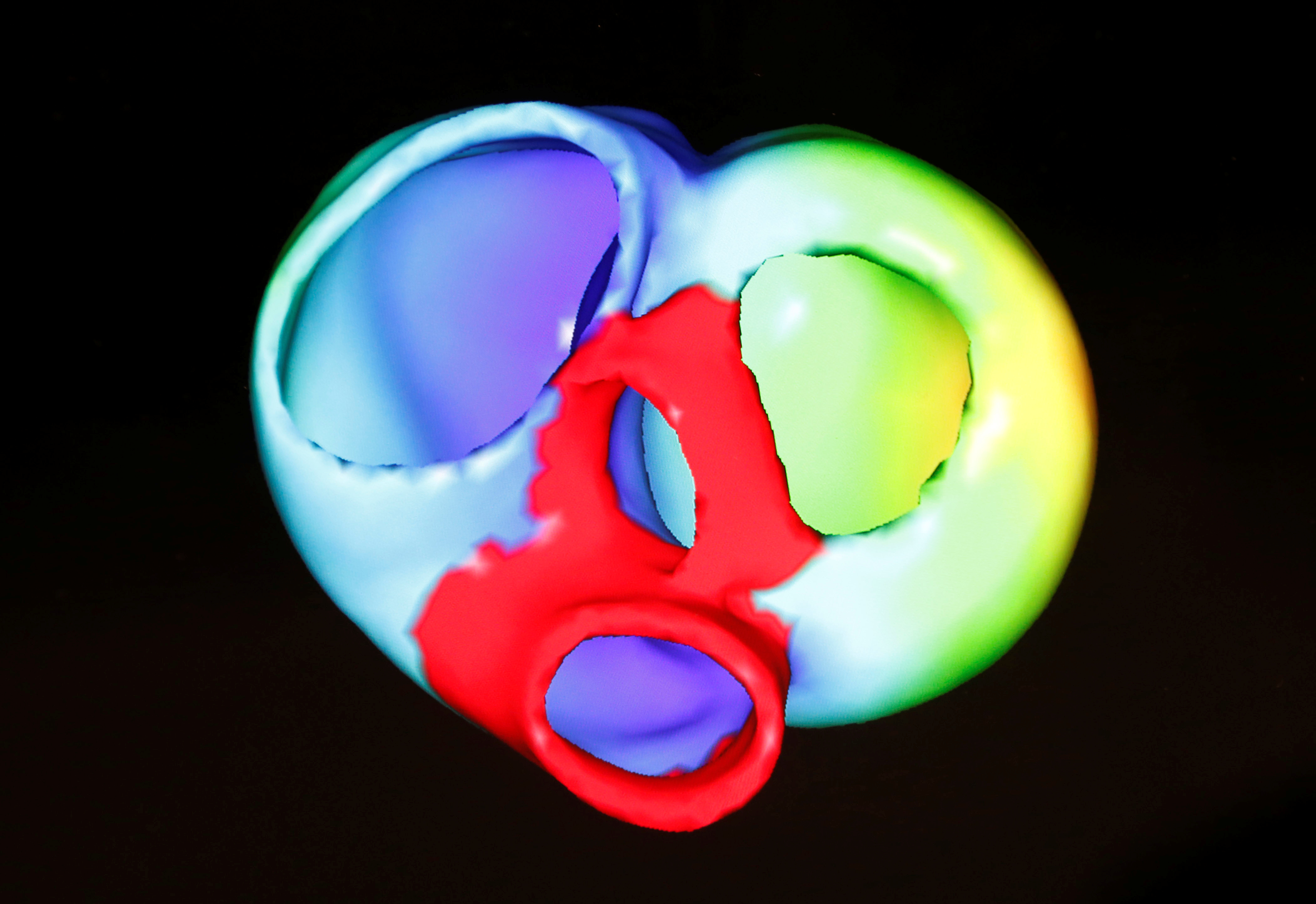 Amgen bets on ChemoCentryx's rare disease drug in $3.7 billion deal ...