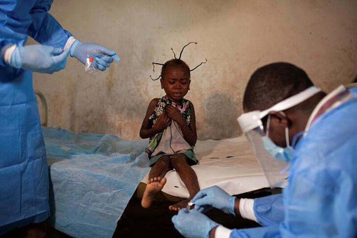 Insight: In Africa's monkeypox outbreak, sickness and death go ...