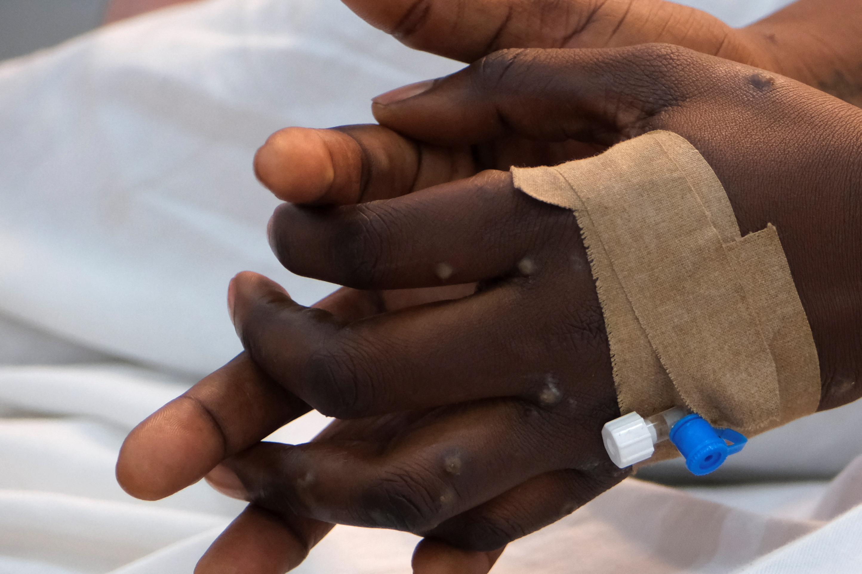 EU delivers first mpox vaccine doses to Congo | Reuters