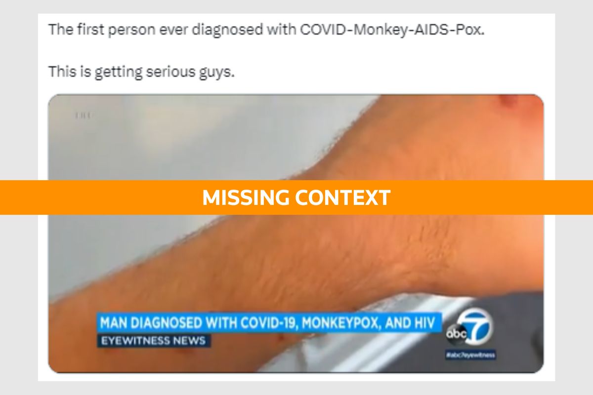 Fact Check: Report on man infected with mpox, COVID and HIV at same ...