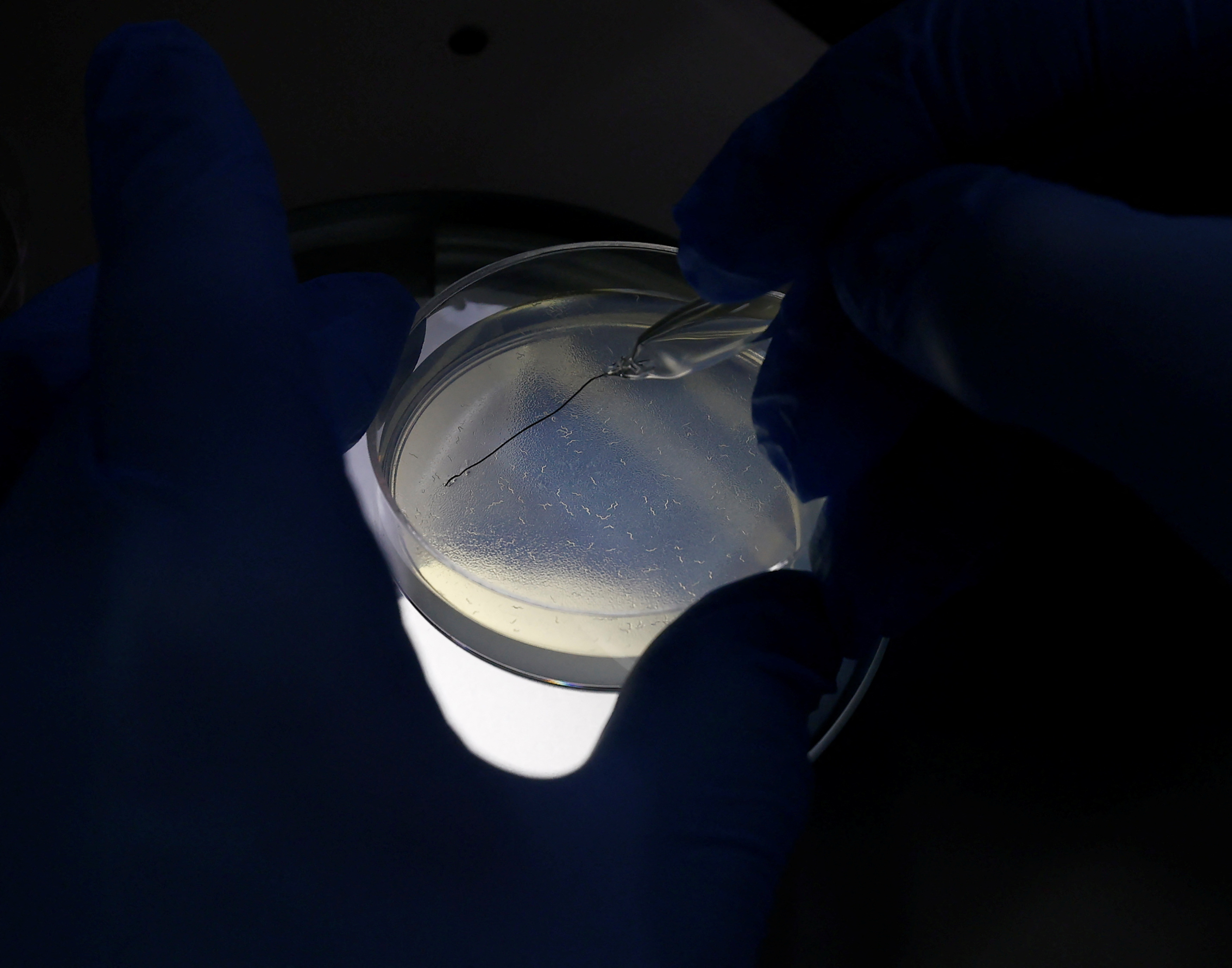 Japanese biotech firm uses tiny worms in test for pancreatic cancer ...